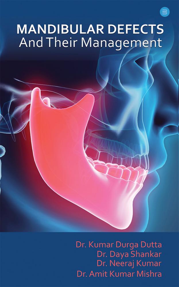 Bookscape | Mandibular Defects and their management