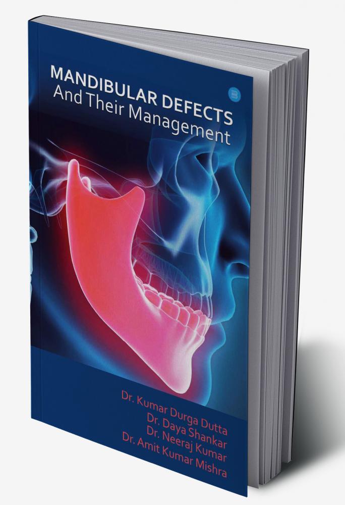 Bookscape | Mandibular Defects and their management